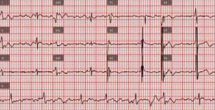 RxBox » RxBox and telemedicine saves lives and transportation costs in ...